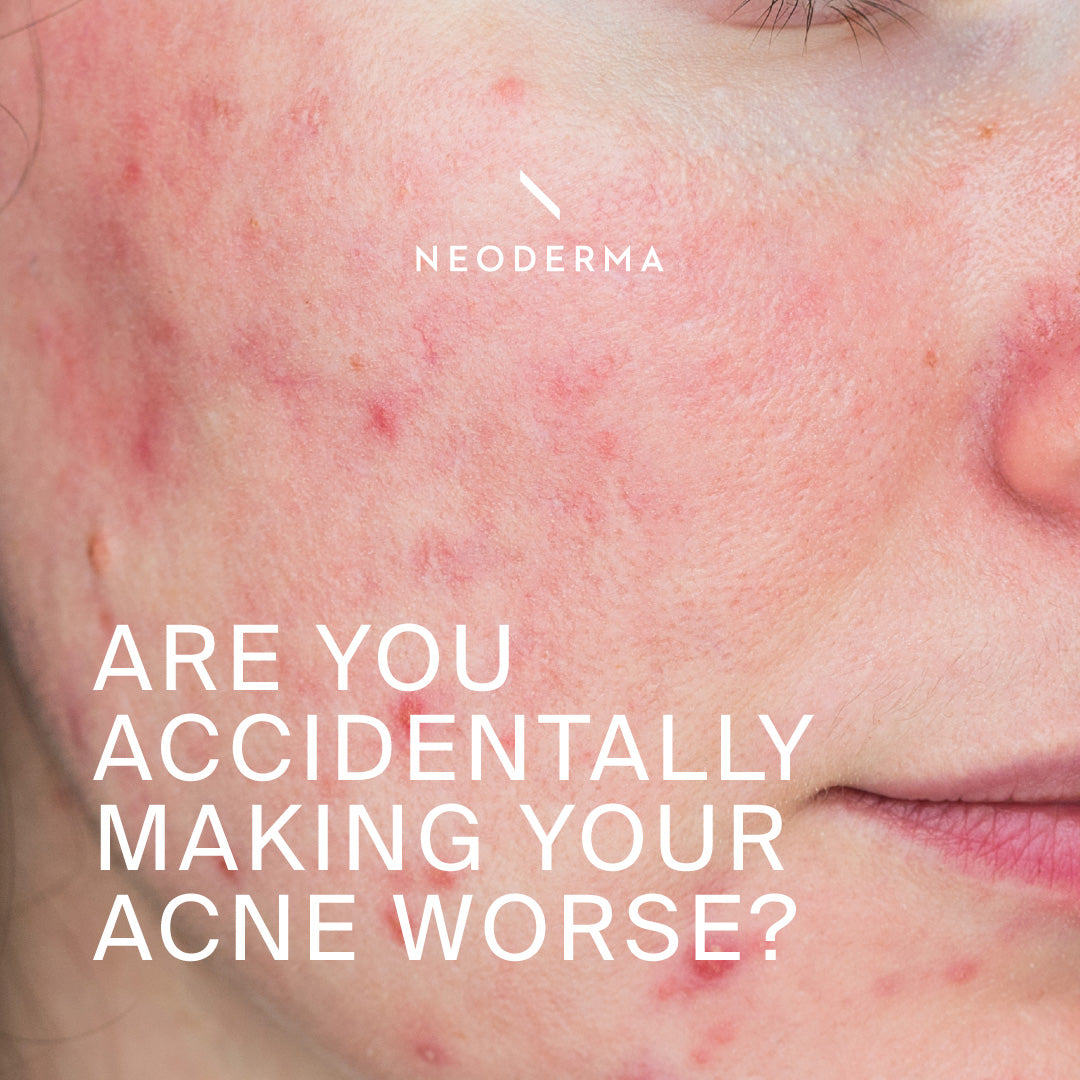 Are You Accidentally Making Your Acne Worse? – NEODERMA