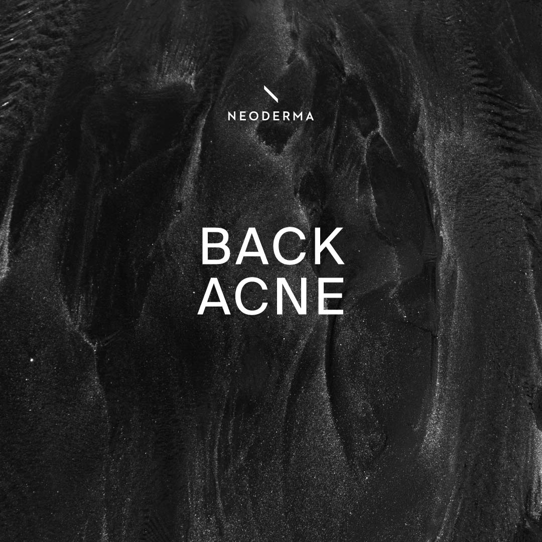 Can Shampoo Cause Back Acne & Baking Soda For Back Acne | NEODERMA