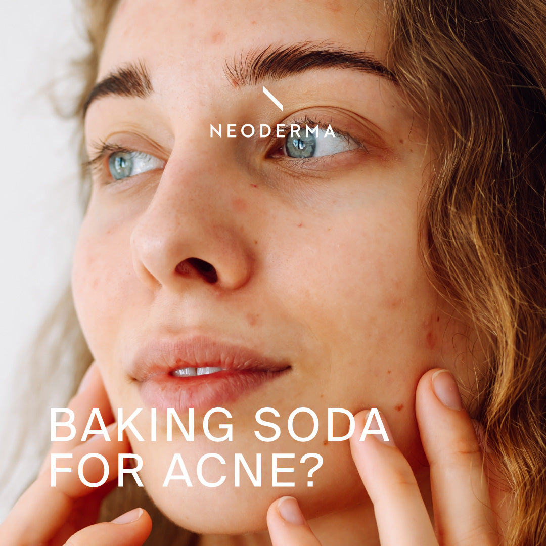 Baking Soda for Acne? – NEODERMA
