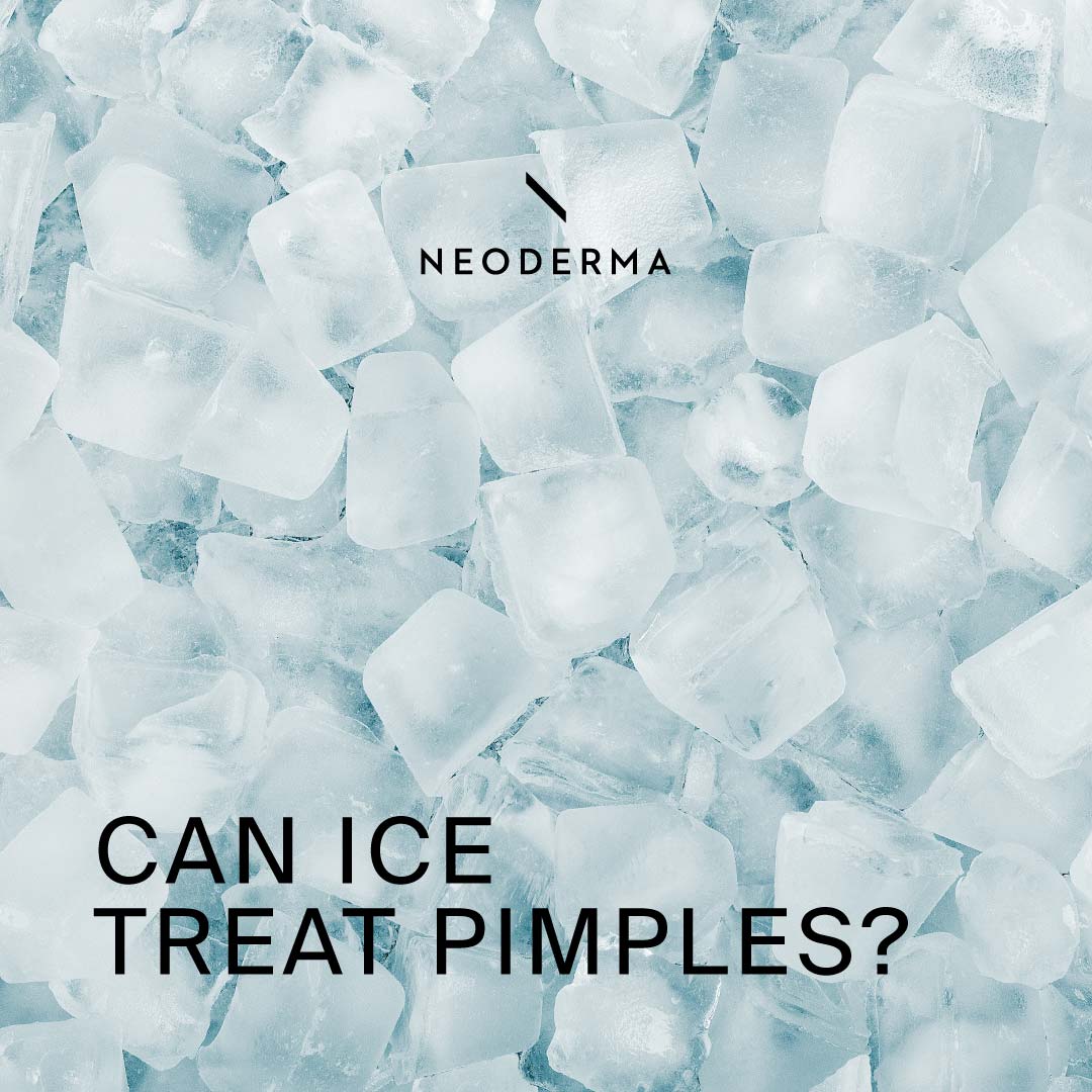 Can Ice Treat Pimples? – NEODERMA