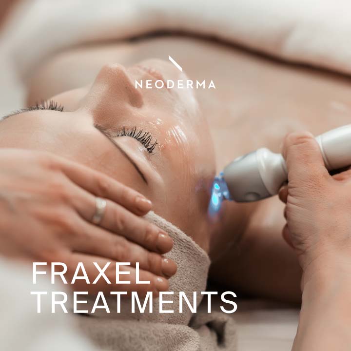 Fraxel Laser Treatments and Balancing Uneven Skin Tone | NEODERMA