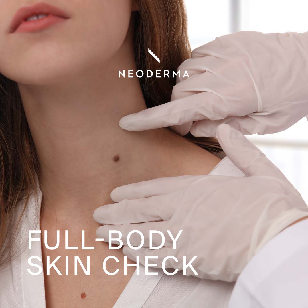 Full Body Skin Check – NEODERMA