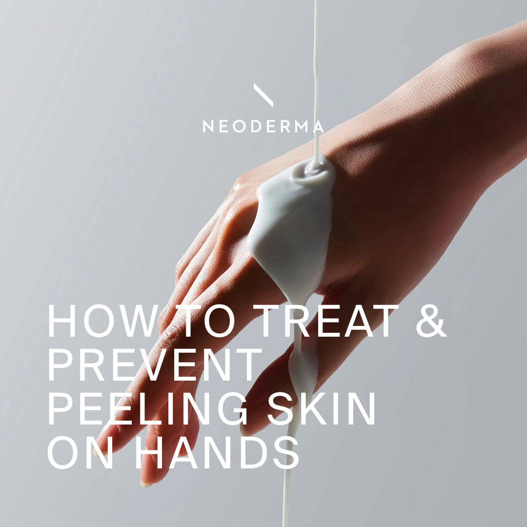 How To Treat And Prevent Peeling Skin On Hands – NEODERMA