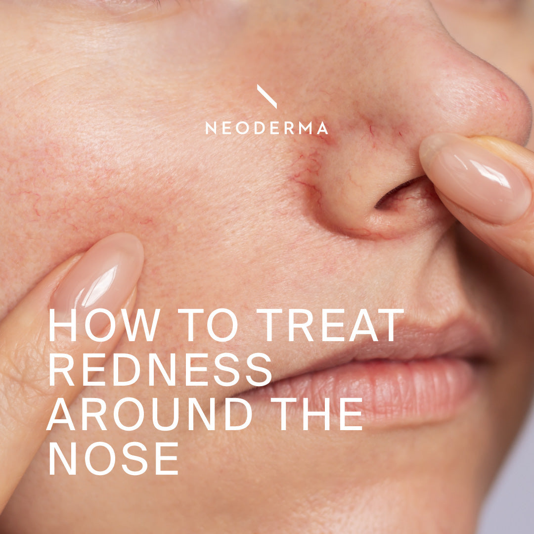 How To Treat Redness Around The Nose – NEODERMA
