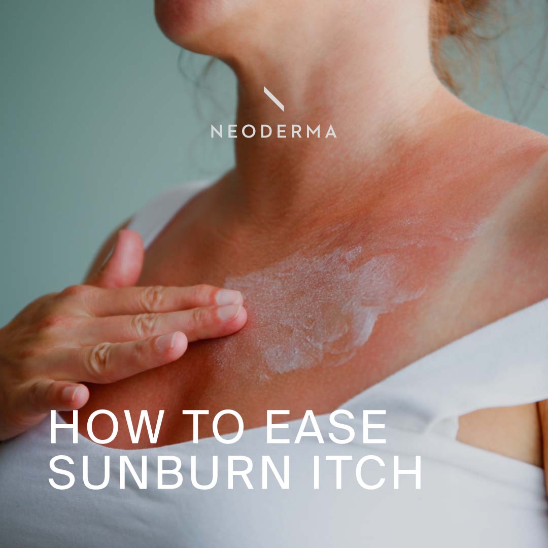 How to Ease Sunburn Itch – NEODERMA