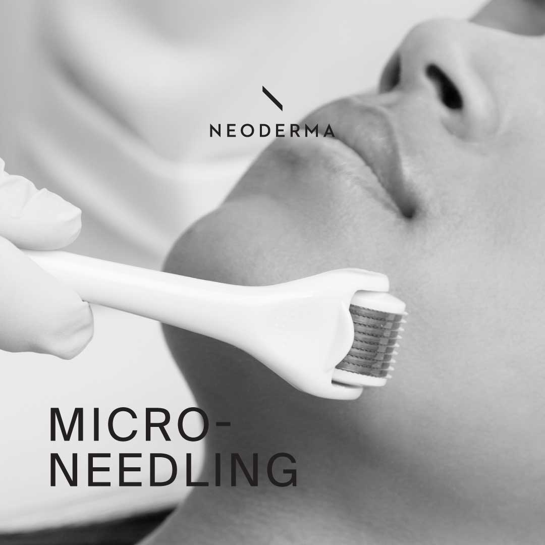 Micro-Needling Skincare | NEODERMA