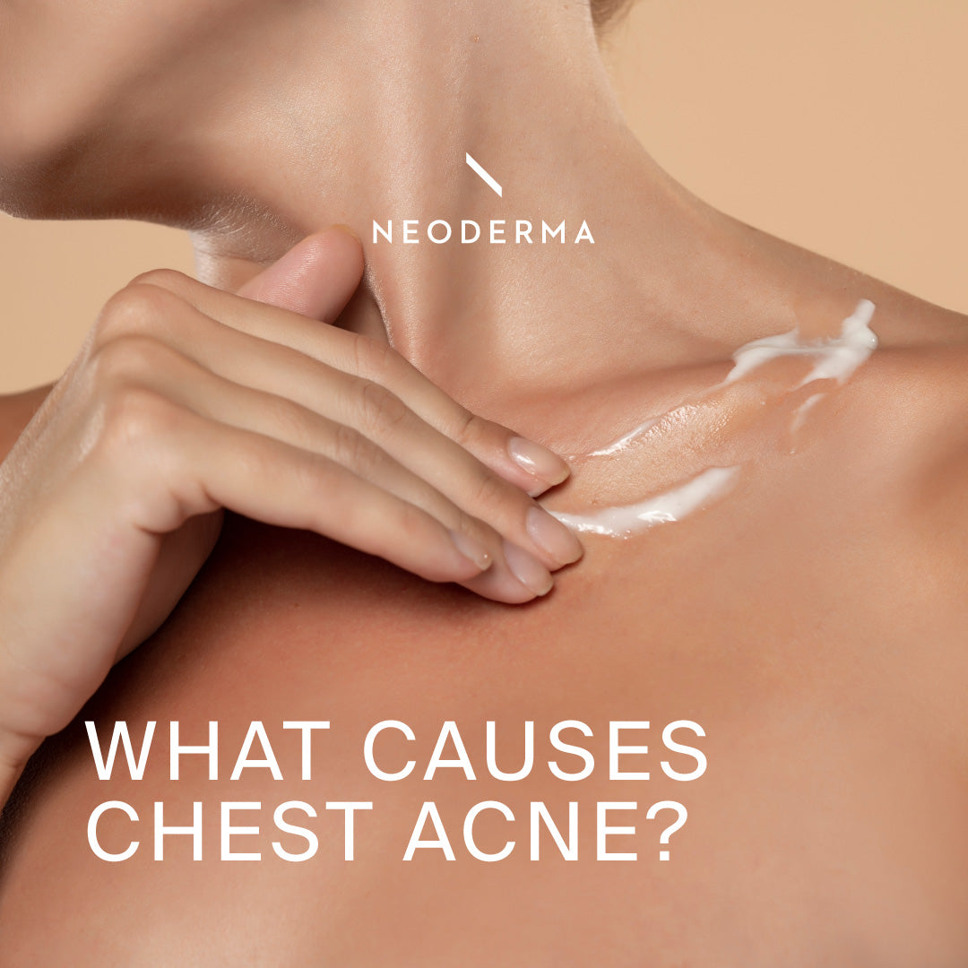 What Causes Chest Acne? – NEODERMA