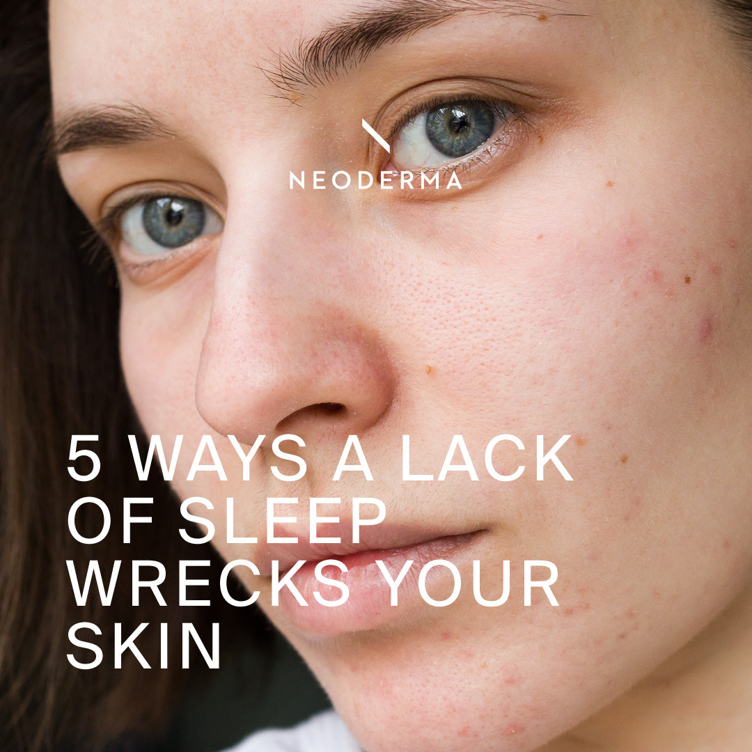 5 Ways a Lack of Sleep Wrecks Your Skin – NEODERMA