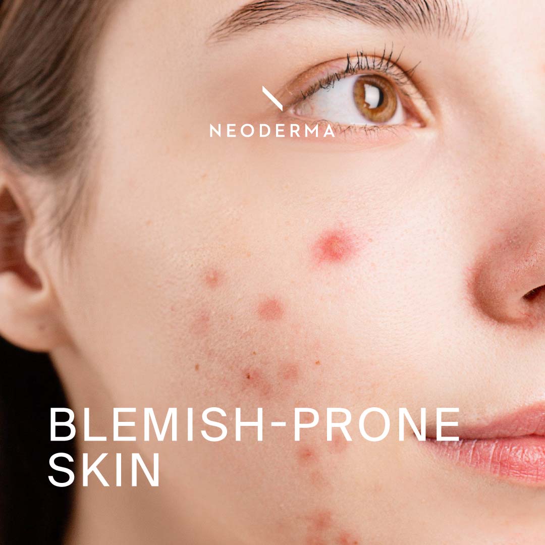 Blemish Prone Skin and Luxury Airless Skincare Moisturizer | NEODERMA