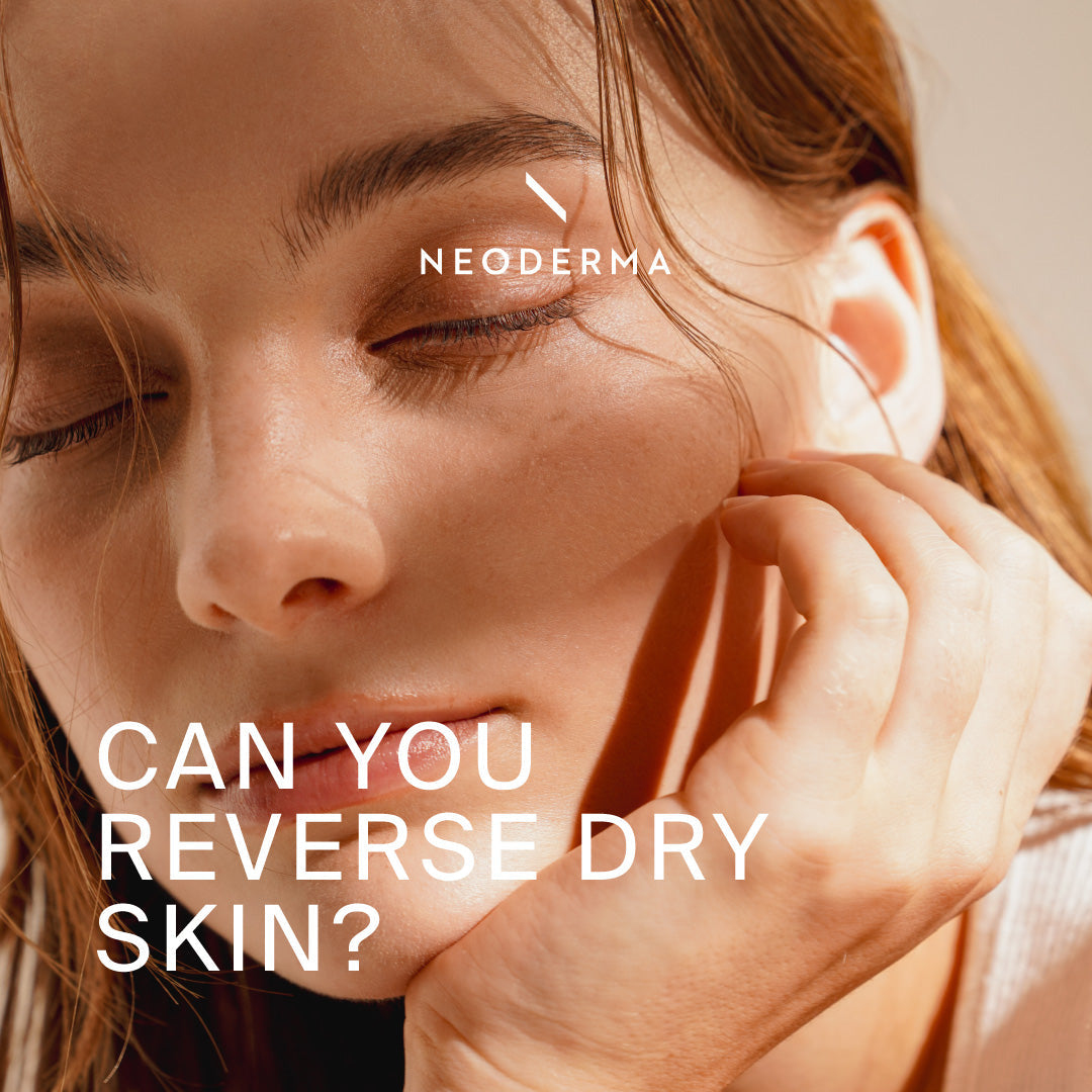 Can You Reverse Dry Skin? – NEODERMA