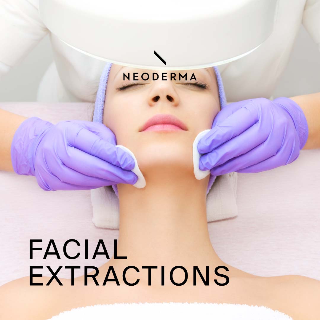 Facial Extractions and Pimples After Facial Treatment | NEODERMA