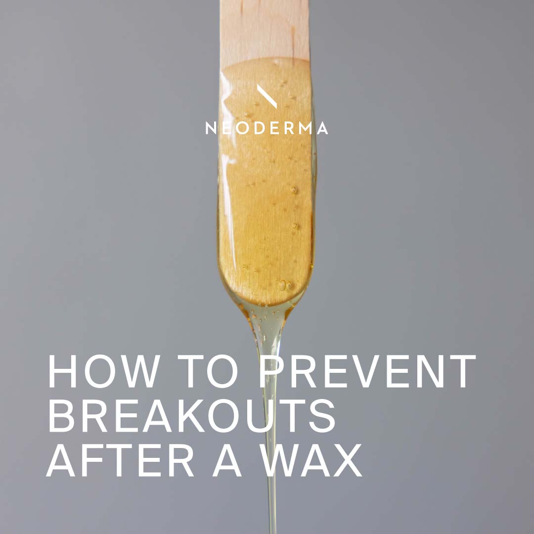 How to Prevent Breakouts After a Wax – NEODERMA