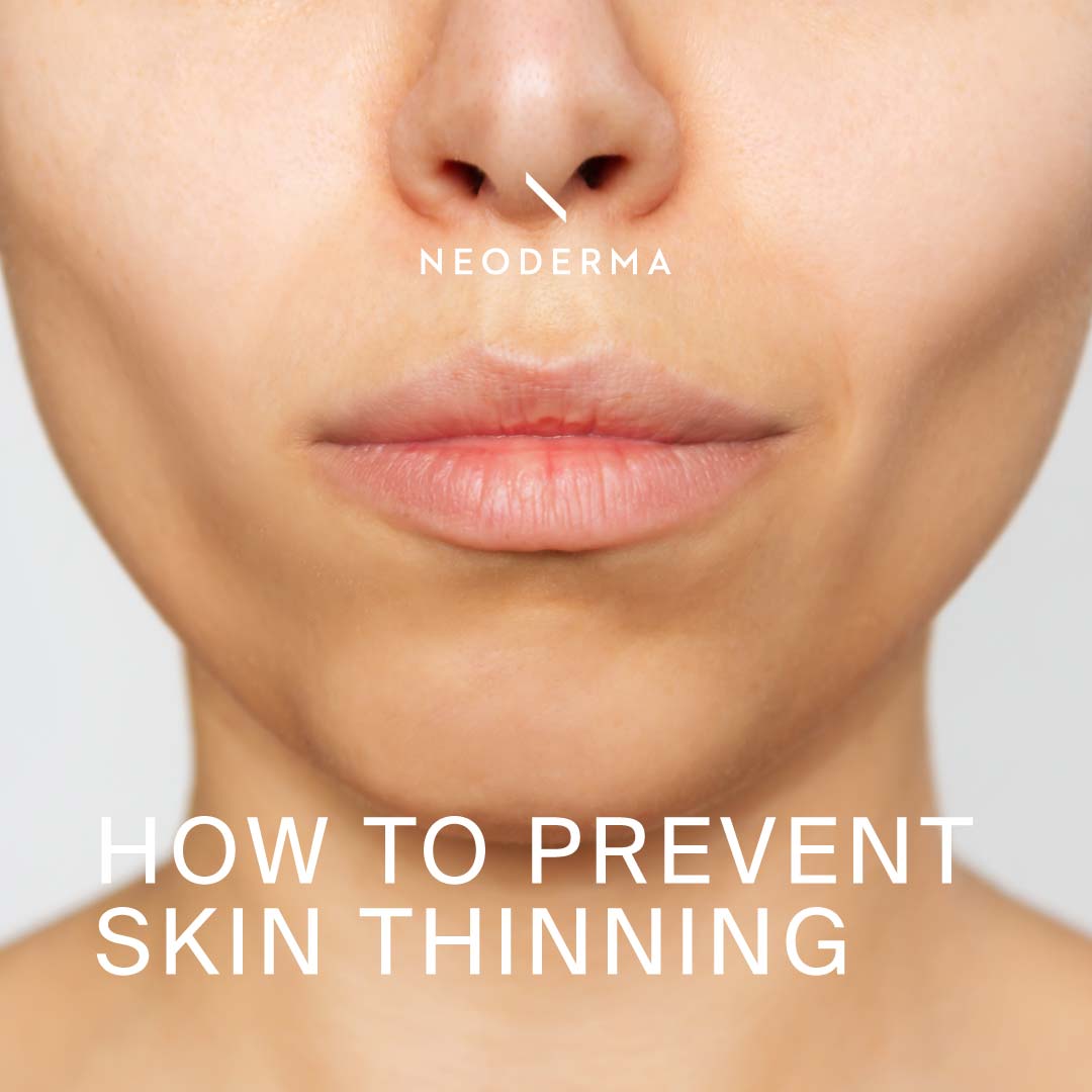 How to Prevent Skin Thinning – NEODERMA