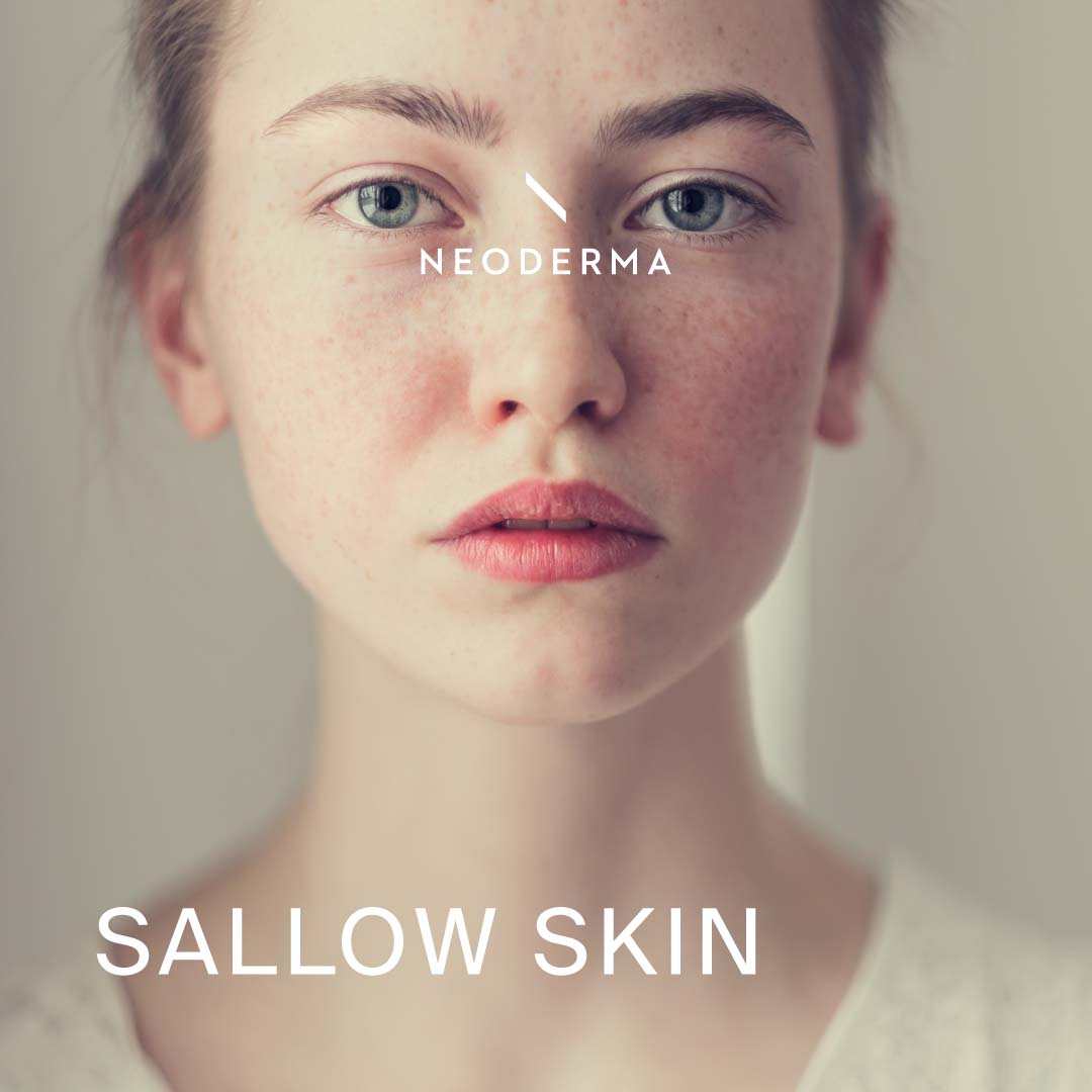 Sallow Looking Skin and Sensitive Skin Care Products | NEODERMA