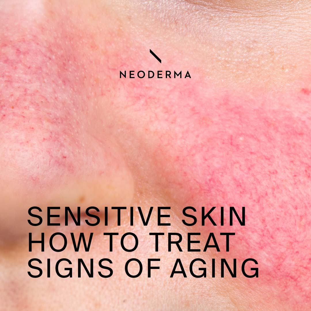 Sensitive Skin, How to Treat Signs of Aging – NEODERMA