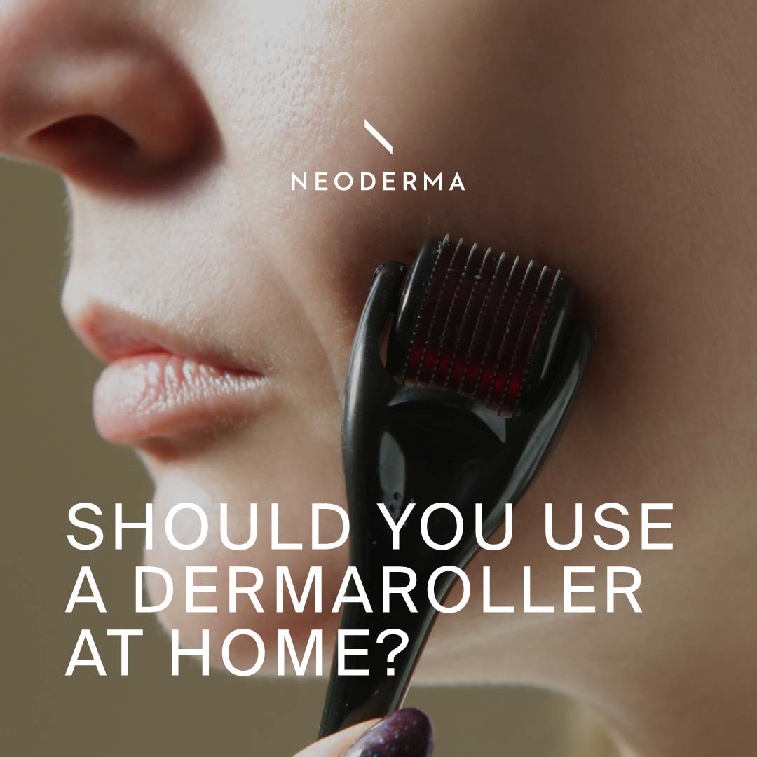 Should You Use a Dermaroller At Home? – NEODERMA