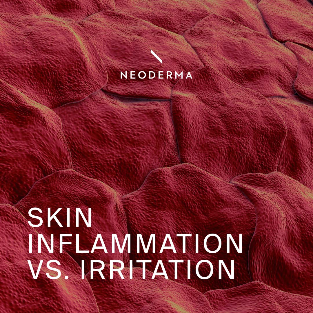 Skin Inflammation Vs Irritation NEODERMA Skin Inflammation Vs Irritation NEODERMA