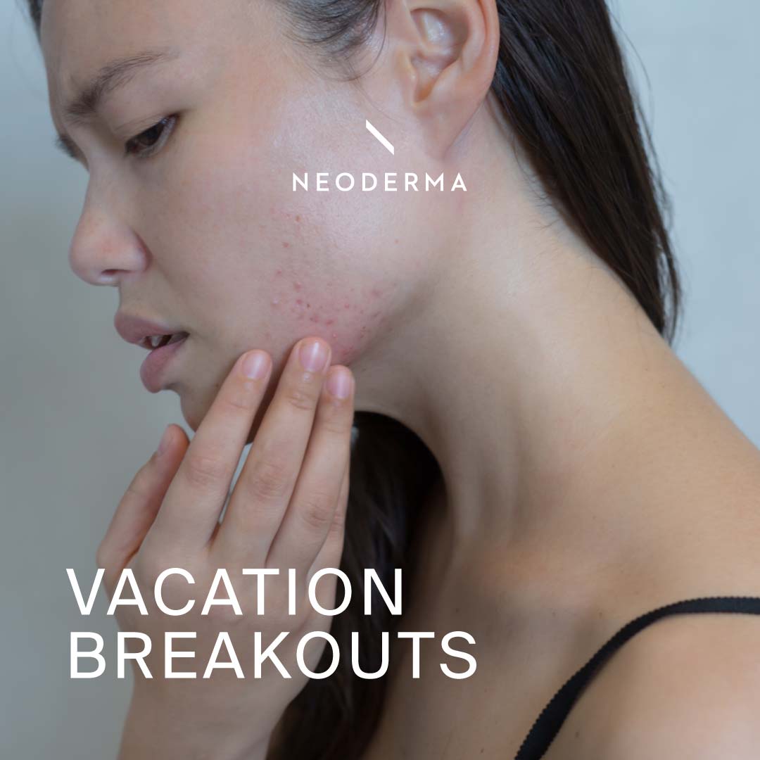 Skincare Vacation Breakouts | NEODERMA