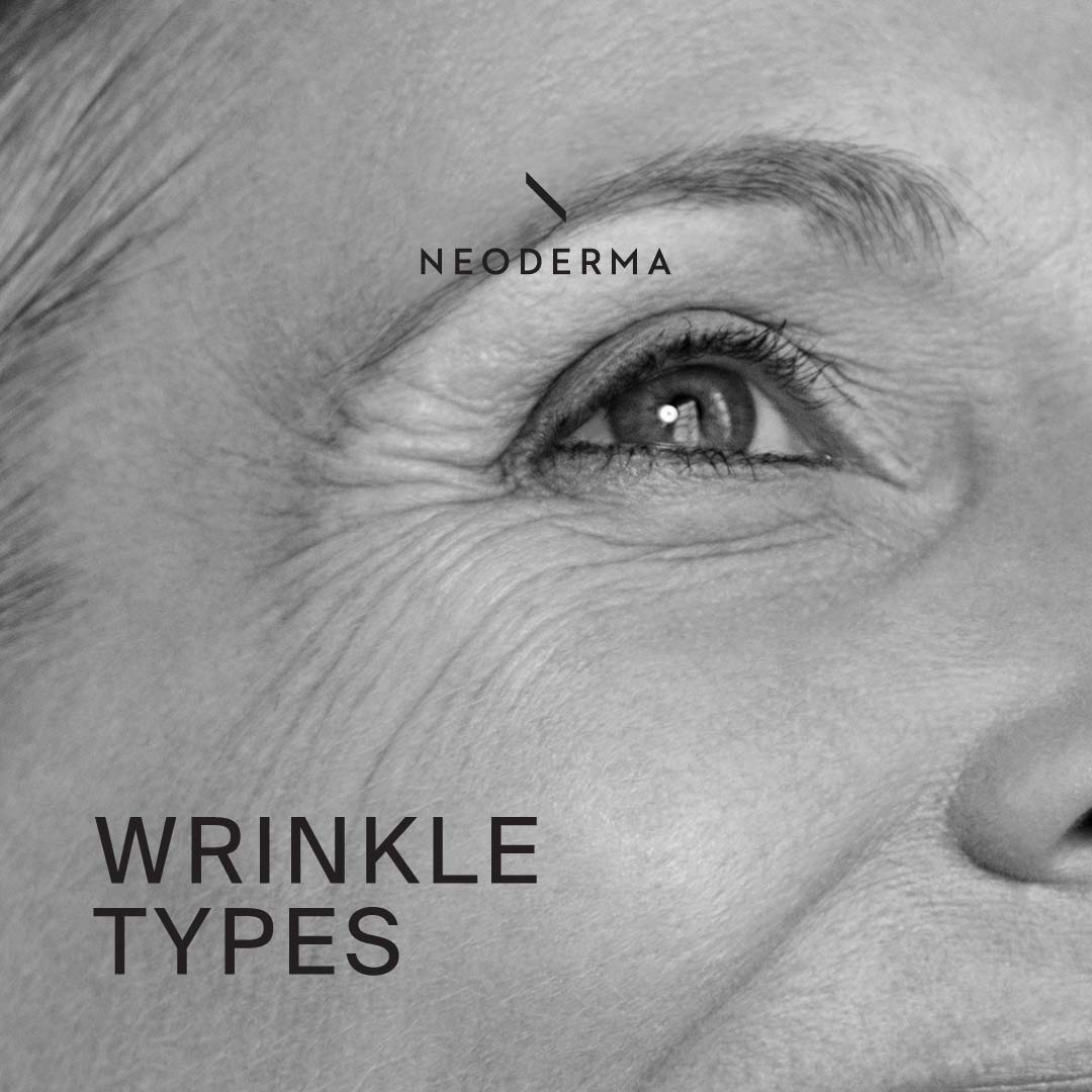 Face Skin Wrinkle Types | NEODERMA