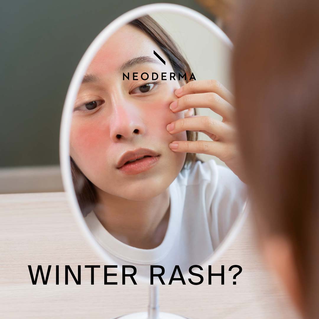Seasonal Winter Rash | NEODERMA